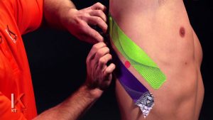 "Properly Supporting Your Ribs with Effective Taping Techniques"
